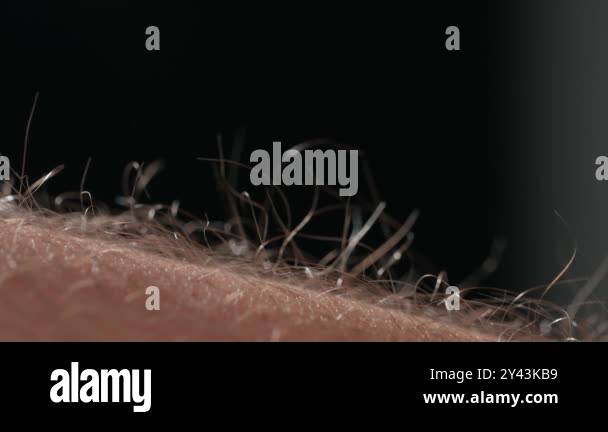 Goose bumps hand Stock Videos & Footage - HD and 4K Video Clips - Alamy