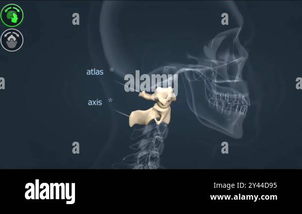 The anatomy of a common carp fish includes a streamlined body covered ...