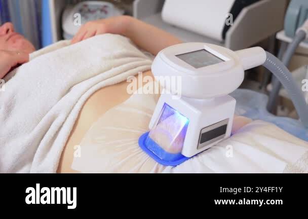 Technique for removing local fat deposits based on controlled cooling ...