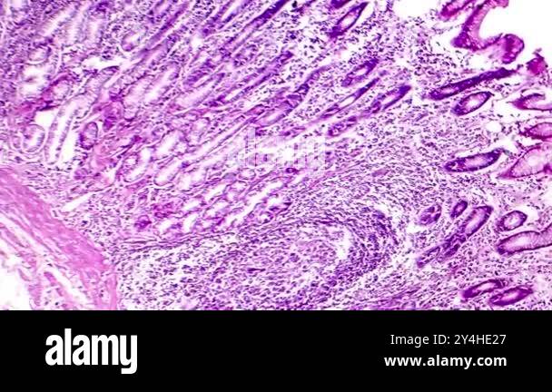 Intestinal lining light micrograph Stock Videos & Footage - HD and 4K ...