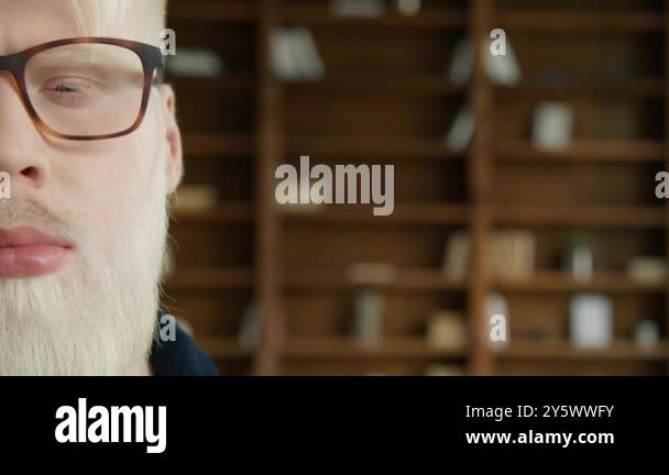 Casual positive albino male in classy eyewear for dental background ...