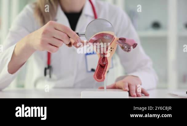 Doctor examines anatomical model of female reproductive system with a ...