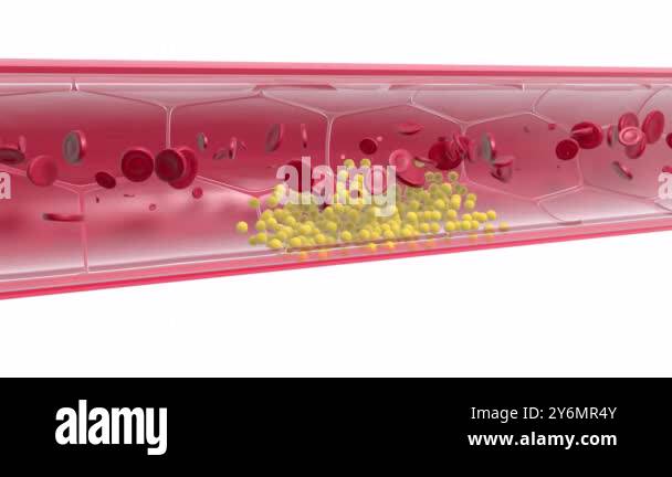 Anatomical 3D animation of the interior of an artery with the movement ...