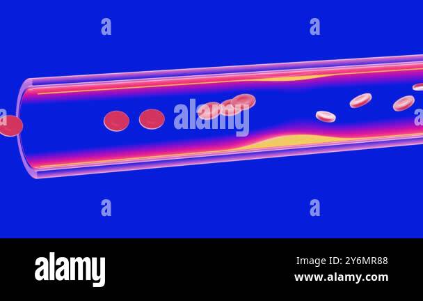 3D animation of the interior of a transparent glass artery with the ...