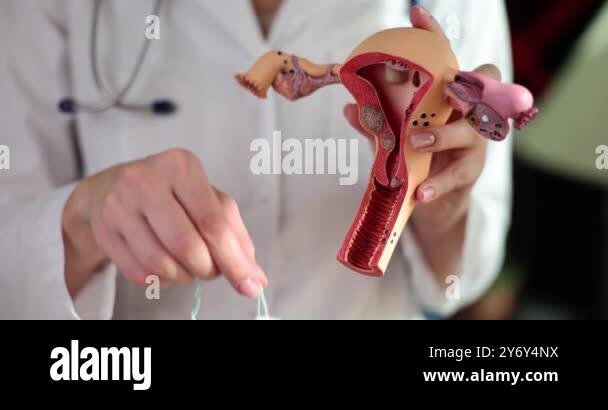 Gynecologist demonstrates model of female reproductive system and ...
