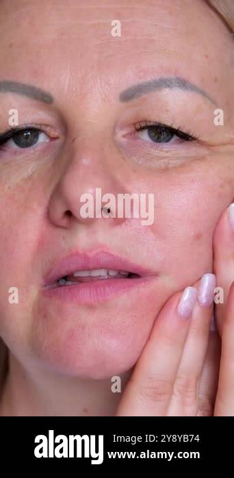 aging facial skin Upper face close up shot of sad elderly mature lady ...