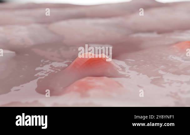 face Acne and Pimples and blackhead growth and spreading uncontrollably ...