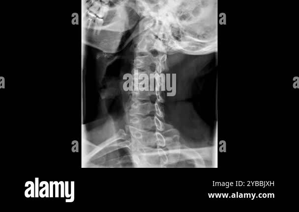 Stop motion of body parts ct or x-ray scan, human spine shoulders and ...