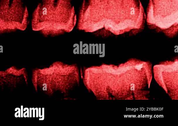 Stop motion of human teeth x-ray or ct scan horror collection. Human ...