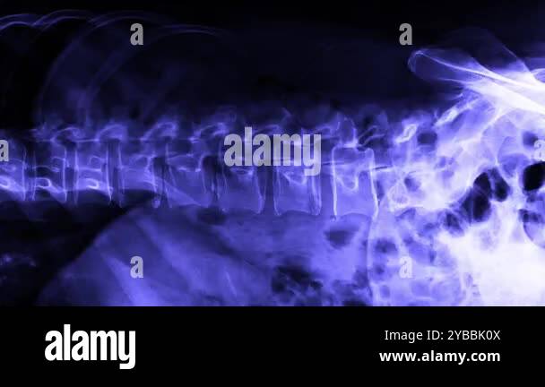 Stop motion of body parts ct or x-ray scan, human spine shoulders and ...