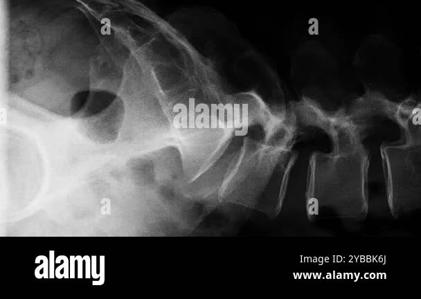 MRI scan timelapse of various sides human body, spine, coccyx bones ...