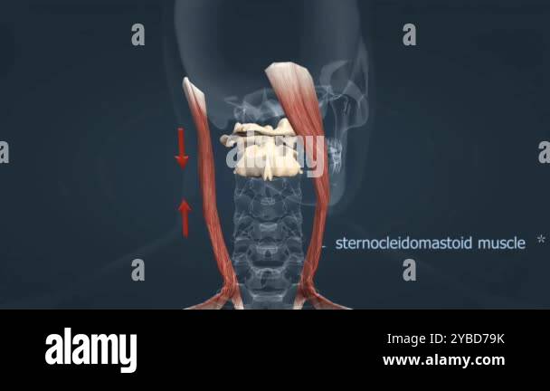 The sternocleidomastoid muscle is a paired neck muscle that extends ...