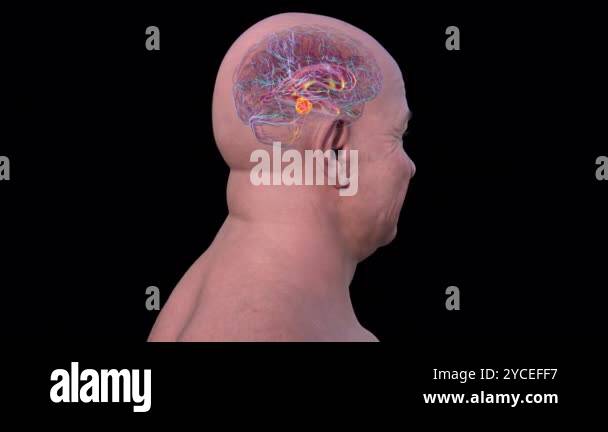 A 3D scientific animation depicting enlarged lateral and third ...