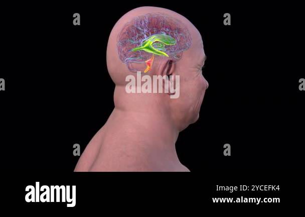 Anatomy of the fourth brain ventricle highlighted in orange color, a ...