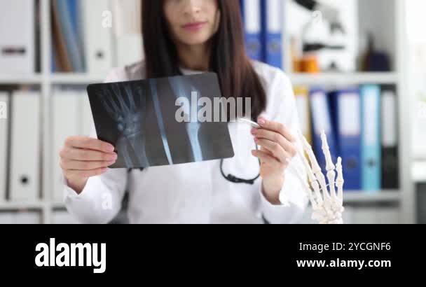 Female doctor examines x-ray photograph of hands. . Medical care when ...