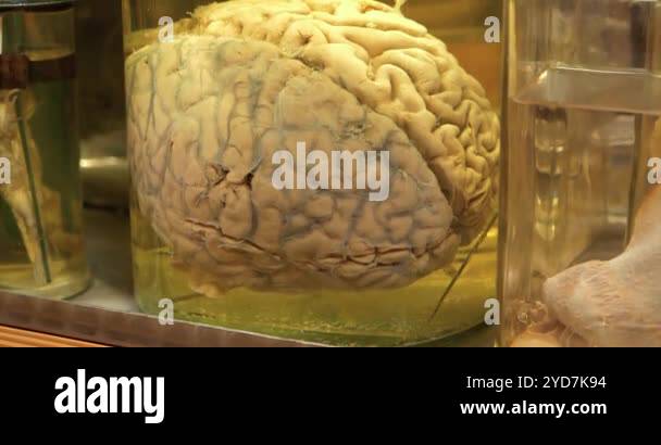 Real human brain. Anatomy of brain, grey substance, grey matter, cortical grey. Human brain in ...