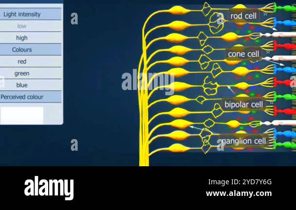 Color vision deficiency, commonly known as color blindness, is a visual ...