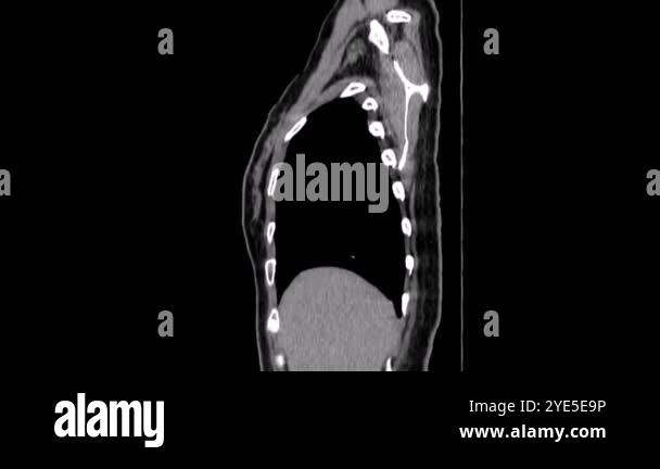 Computed tomography (CT) scan moving from the left to the right of the ...