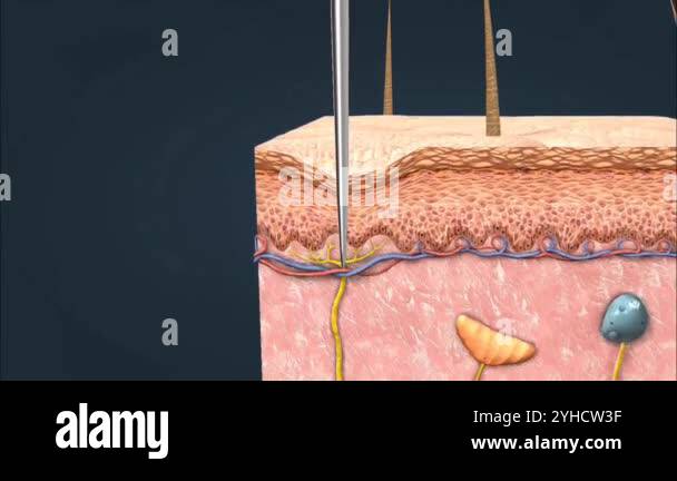 Pain modulation Stock Videos & Footage - HD and 4K Video Clips - Alamy