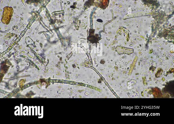 microorganisms and soil biology, with nematodes and fungi under the microscope. in a soil and ...