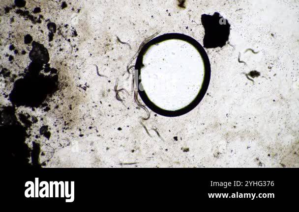 microorganisms and soil biology, with nematodes and fungi under the microscope. in a soil and ...