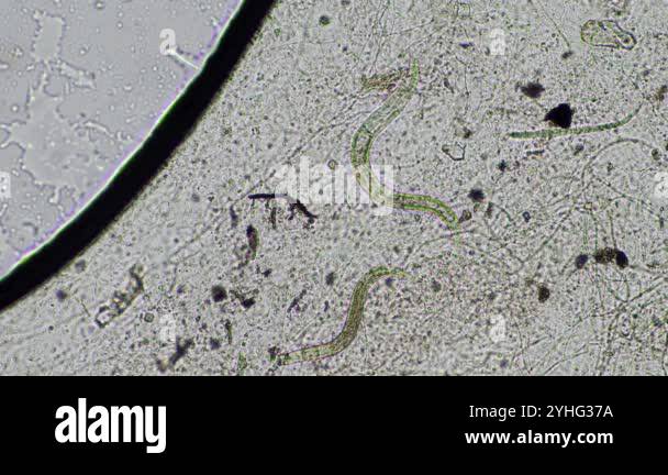 microorganisms and soil biology, with nematodes and fungi under the microscope. in a soil and ...