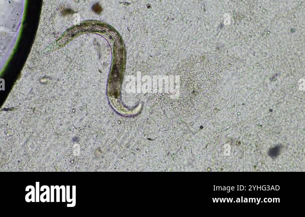 microorganisms and soil biology, with nematodes and fungi under the microscope. in a soil and ...