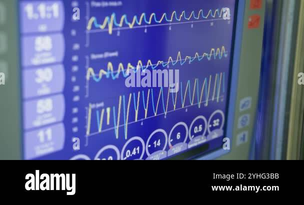 Medical monitor displaying patient vital signs in NICU. Detailed view ...