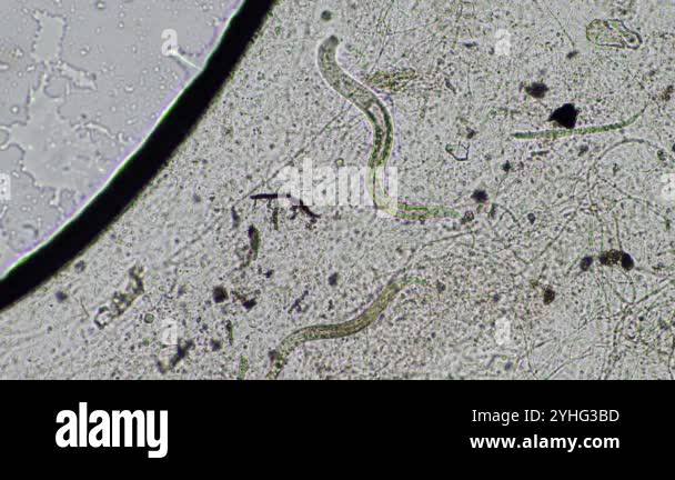 microorganisms and soil biology, with nematodes and fungi under the microscope. in a soil and ...