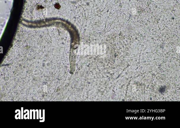 microorganisms and soil biology, with nematodes and fungi under the microscope. in a soil and ...