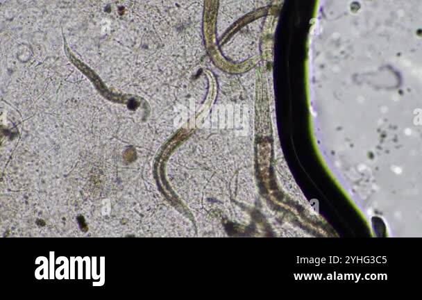 microorganisms and soil biology, with nematodes and fungi under the microscope. in a soil and ...