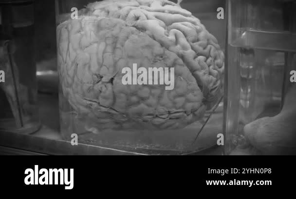 Autopsy historic Stock Videos & Footage - HD and 4K Video Clips - Alamy