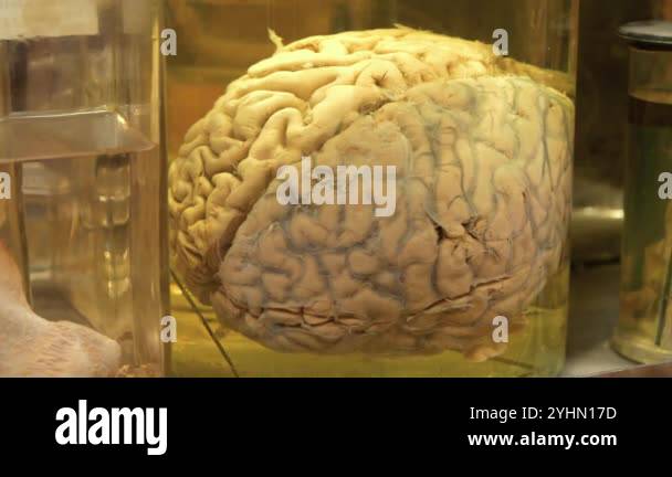 Real human brain. Anatomy of the brain. Human brain in glass jar with ...