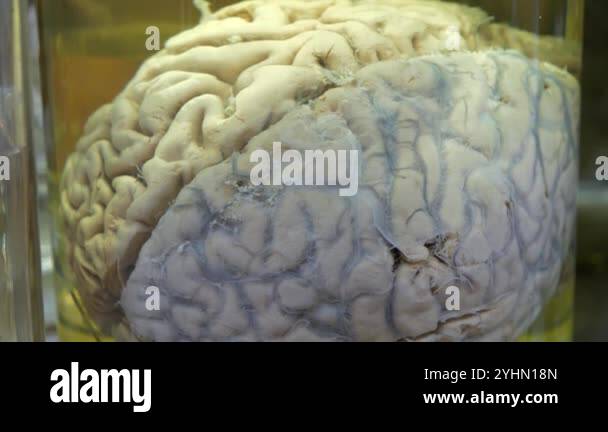 Real human brain. Anatomy of the brain, grey substance, grey matter ...