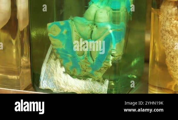 Cattle brain. Animal brain in glass jar with formaldehyde for medical ...