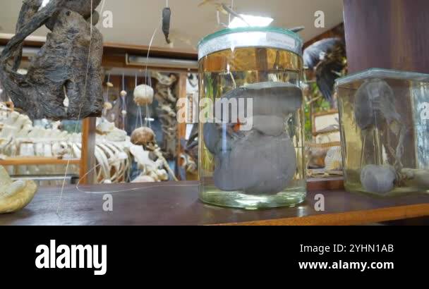 Human liver in glass flask. Major metabolic organ, which performs many ...