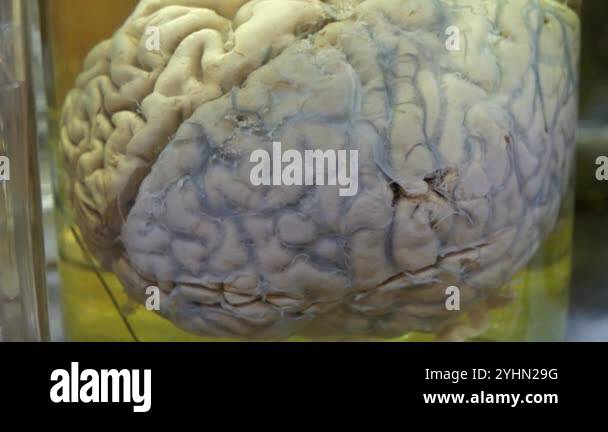 Human brain in flask. Anatomy of the brain, convolutions of brain, gyri ...