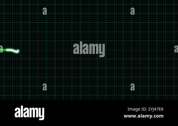 An ECG waveform provides a visual representation of heartbeats ...