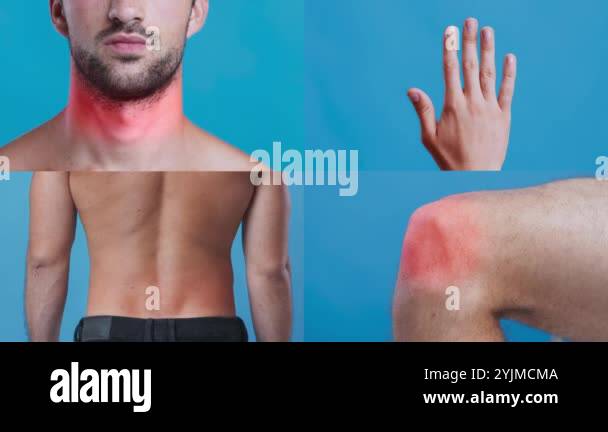 A man model displays various painful areas on his body, showing red ...