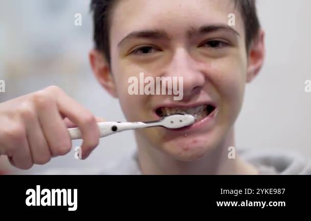Close up boy teenager brushing teeth in front of mirror, acne on skin ...