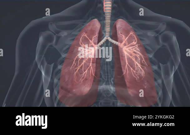 The human lungs consist of the right and left lungs, bronchi, alveoli ...