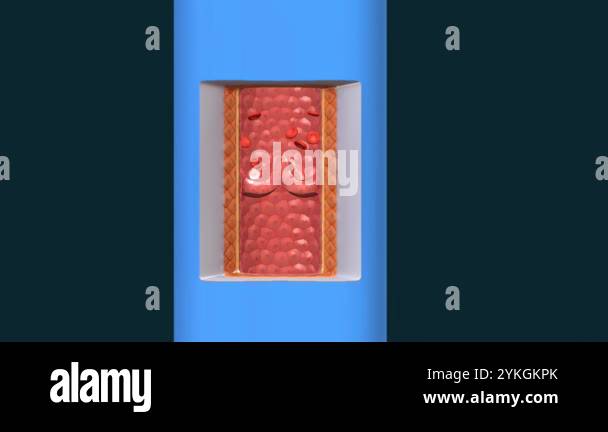 Detailed view of a venous valve, highlighting its function in blood ...