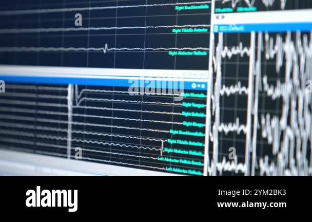 Multiple curved lines run by the screen. Brain work display at the ...