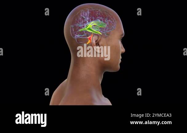 Anatomy of the fourth brain ventricle highlighted in orange color, a ...