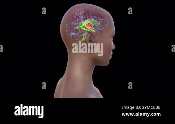 A 3D scientific animation showcasing the third brain ventricle, a vital component of the brains ...