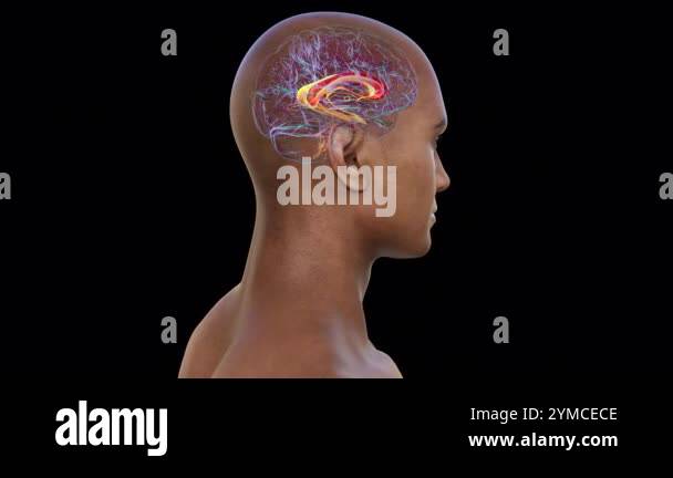 Human brain with highlighted corpus callosum connecting brain hemispheres, and ventricles ...
