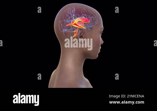 Ventricular system of the brain, 3D animation. The ventricles are ...