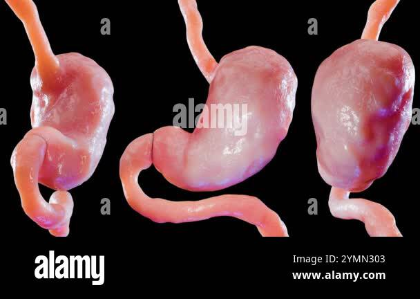 Human Stomach Anatomy Digestion, esophagus abdomen gastric with acid ...