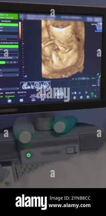 Ultrasound machine screen displaying a 3D image of a baby in the late ...