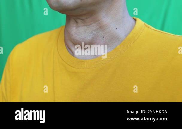 Thyroid gland inflammation at neck, goiter, throat cancer, sore throat ...